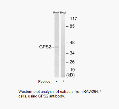 GPS2 Antibody | AAT Bioquest