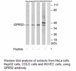 GPR52 Antibody | AAT Bioquest